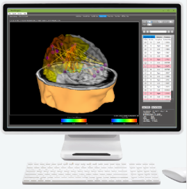 NeuroNavigator’s swLORETA Functional Connectivity Normative Database – Mind Media USA