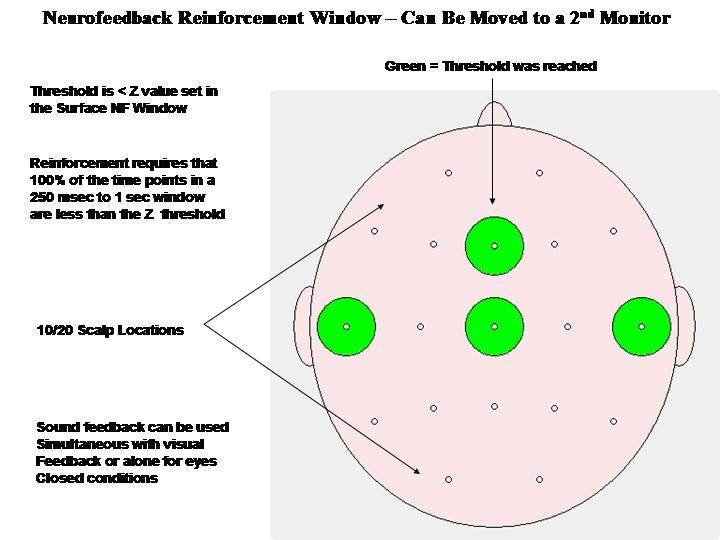 NF2- 19 Ch. LORETA Z-Score Neurofeedback – NeXus | NSET Mind Media